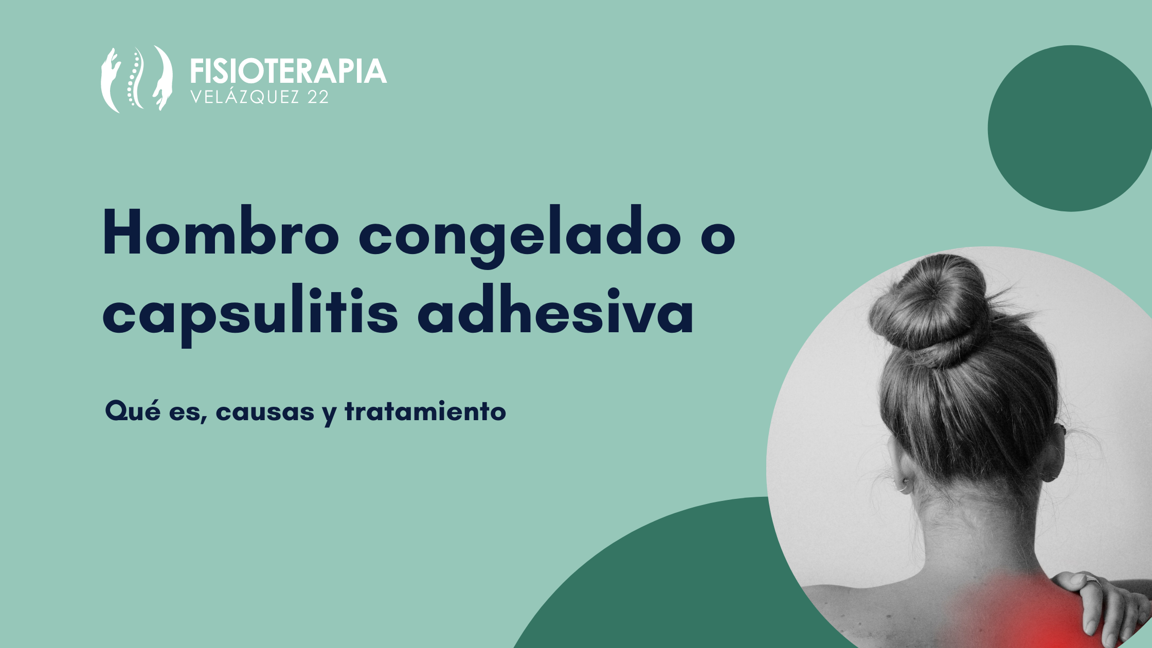 Hombro Congelado O Capsulitis Adhesiva: Qué es y Tratamiento